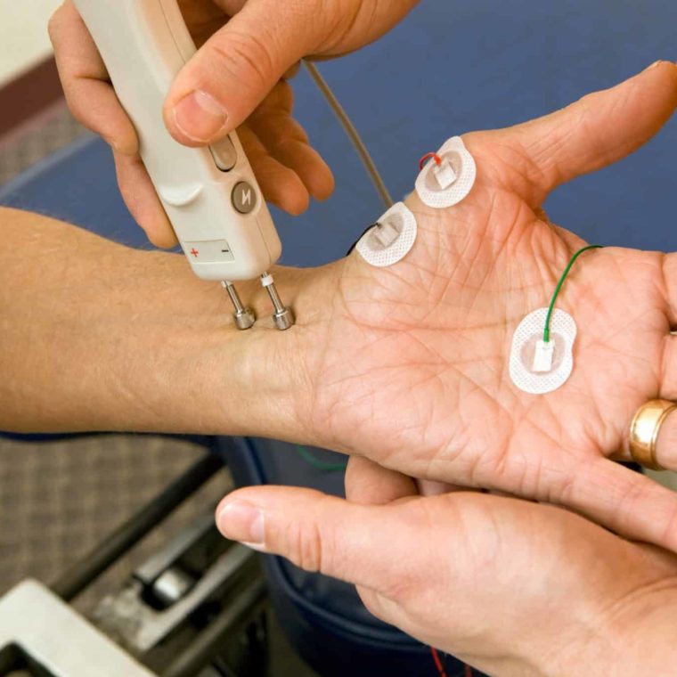 Chiropractor Performing A Median NCV (Nerve Conduction Velocity) Test ...